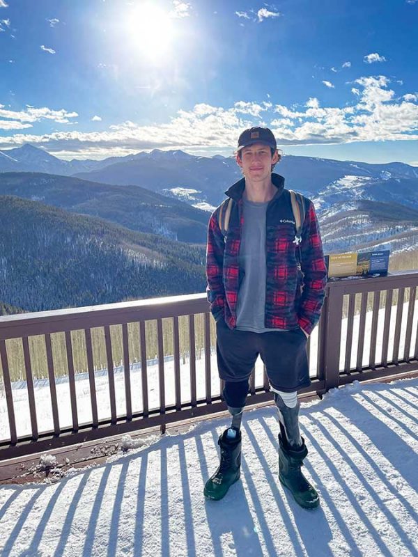 Adapt and Overcome: The Story of Bilateral BK Amputee, Austin Lewis – BOEC